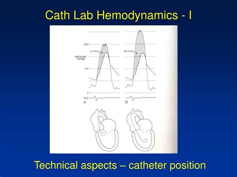 Ppt Cath Lab Hemodynamics I Pressure Tracings In The Diseased