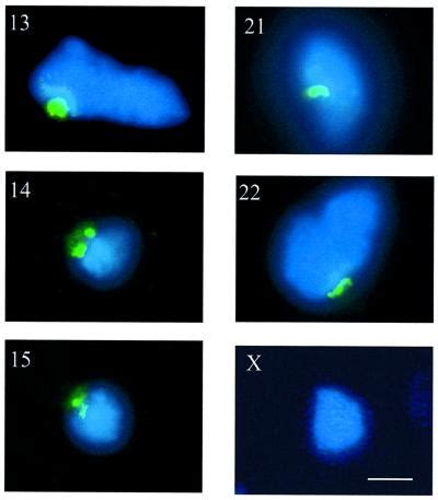 Human Acrocentric Chromosomes With Transcriptionally Silent Nucleolar