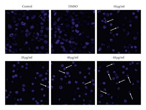 Dapi Staining And Flow Cytometry Analysis Of Apoptotic Death Of