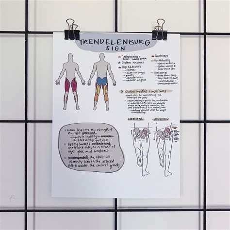 Human Anatomy Study Notes Art Print Lower Body Etsy UK