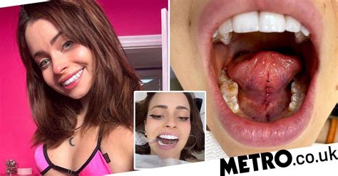 Influencer Cuts Off Part Of Tongue To Improve Kissing Skills Metro News
