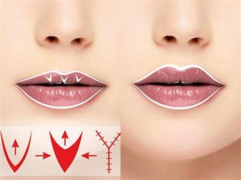 Cirurgias de Lábios Conheça 3 feitas por Cirurgiões Dentistas