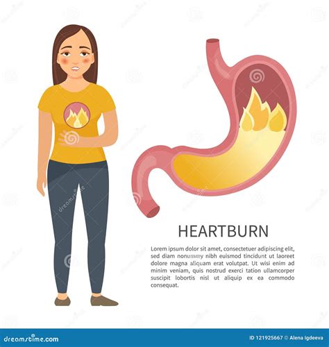 Infographics Of Gastritis Vector Illustration
