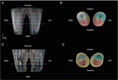 Typical Quantitative Magnetic Resonance Imaging Acquisitions And