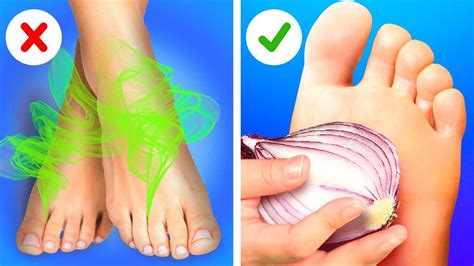 No More Smelly Feet 🤢 Cool Feet Hacks And Diy Shoes Youtube