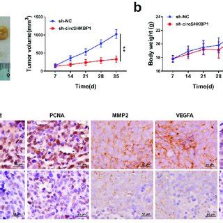 Silencing Of CircSHKBP1 Suppressed The Tumorigenesis Of LSCC In Vivo