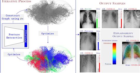 The Renaissance Of The Graph P Laplacian In The Deep Learning Era