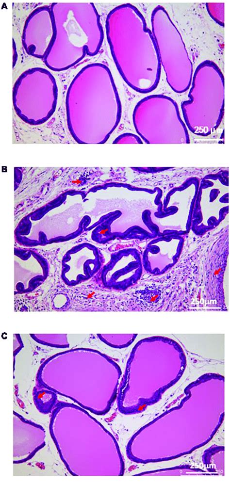 Histological Morphology Of Prostatic Tissue In Each Group A The