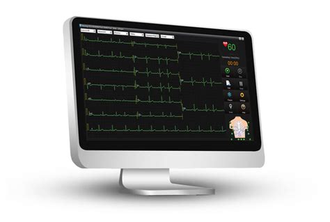 SE Treadmill Stress ECG Ekg Machine Alltrustedmed