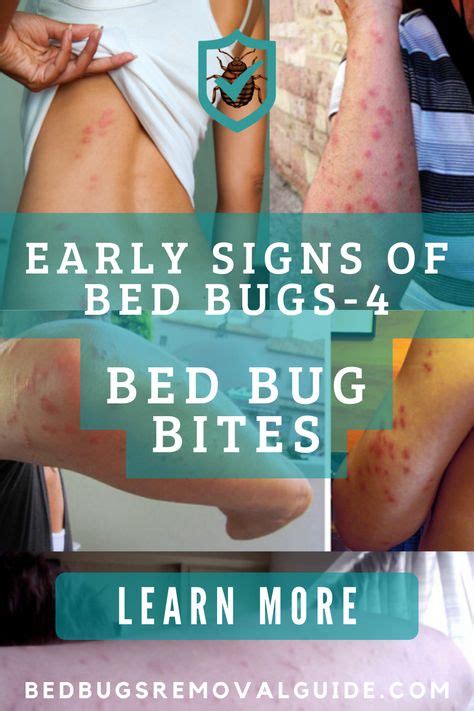 You Will Not Notice Bed Bugs Biting You During The Bite A Natural