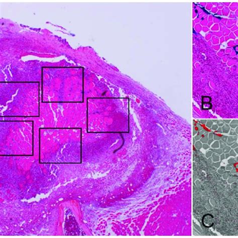 Bacterial Quantification To Evaluate The Correlation Between The
