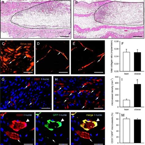 Histomorphology Of Subcutaneous Adipose Tissue From Lean And Obese