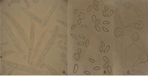 Spores Of Fusarium Sp Nov A Macroconidia B Microconidia And C