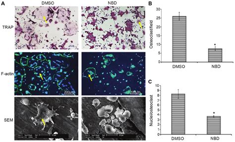 Nbd Peptide Inhibits Rankl Induced Osteoclast Formation And Function In