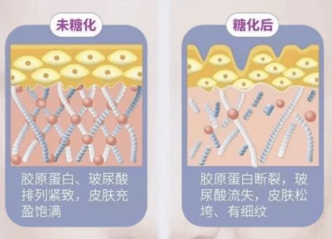 戒糖的重要性糖对肌肤影响有多大 伊的家