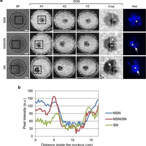 Chromatin Structure In Mouse Oocytes Visualized By Ocm A Chromatin Download Scientific