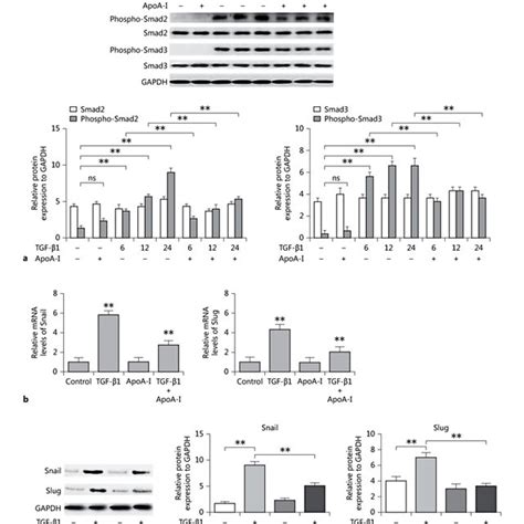 Apoa I Inhibits Tgf β1 Induced Endmt Of Human Coronary Artery