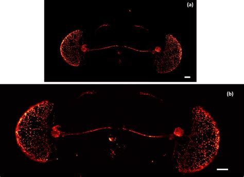 Depicts The Photograph Of A Five Day Old Adult Drosophila Melanogaster