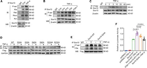 Sox10 Escalates Vascular Inflammation By Mediating Vascular Smooth