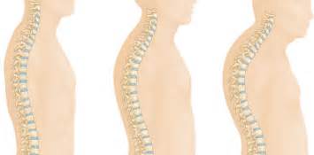 Osteoporosis You Are At Risk Unless You Know You Arent