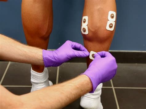 Video Assessment Of Neuromuscular Function Using Percutaneous Electrical Nerve Stimulation