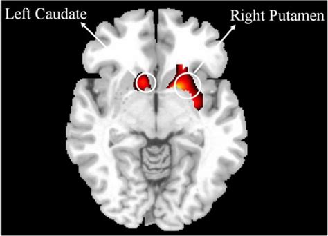 Improve Physical And Mental Health During Aging With Mindfulness