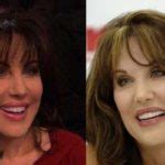 Robin Mcgraw Plastic Surgery Claims