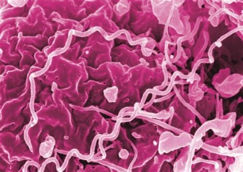Los 7 Tipos De Bacterias Y Sus Características Con Ejemplos
