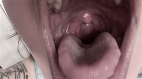 Bbw Girl Swallow A Ring Whole