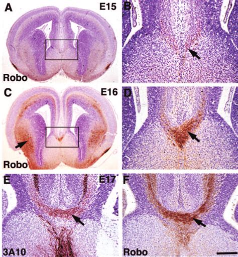 Callosal Axons Express Robo Receptors Robo Download Scientific Diagram
