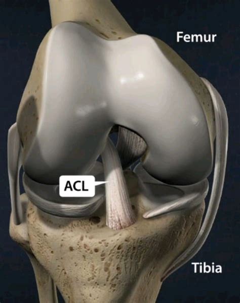 Lateral Femoeral Condyle In Acl Dr Altaf Khan Posted On The Topic