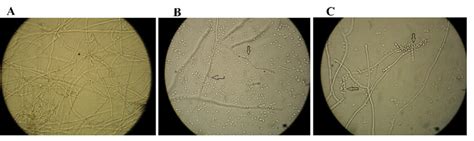 Effect Of The Yeasts A Pullulans Pp4 And A Pullulans Zd1 On A Flavus Download Scientific