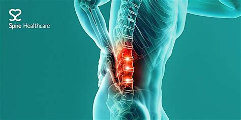 Spire Classroom Mr Neil Donnelly Consultant Ent Surgeon Spire