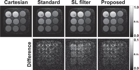 t1mes images were reconstructed using 2d fourier transform of the