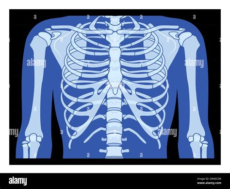 Anatomia Tc Encefalo Immagini Vettoriali Stock Alamy
