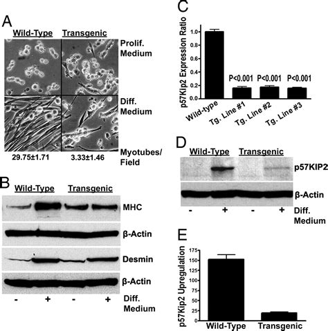 Pax3 Foxo1 Controls Expression Of The P57kip2 Cell Cycle Regulator