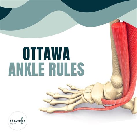 Faraz Sethi On Linkedin Ottawa Ankle Rules Current Emergency