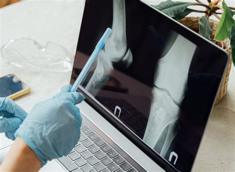 Claves Para Prevenir La Osteoporosis Tweetsalud
