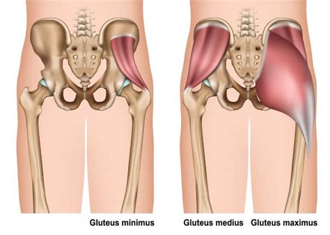 Gluteus Medius Tear Gluteus Minimus Tear Orthopedic Hip Specialist Manhattan New York