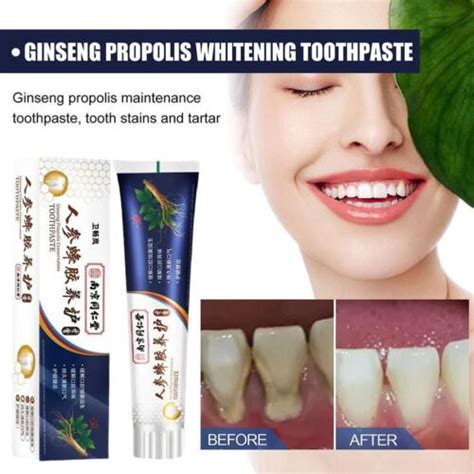 Loose Teeth Care Toothpaste For Gingivitis Treatment And Cavity т