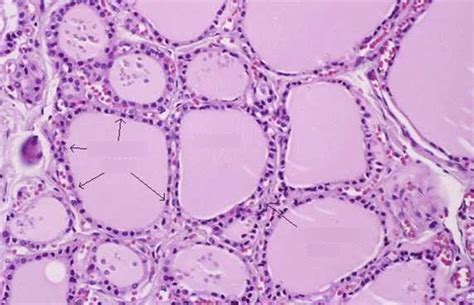 Anatomy And Embryology Of Endocrine Glands Thyroid And Parathyroid