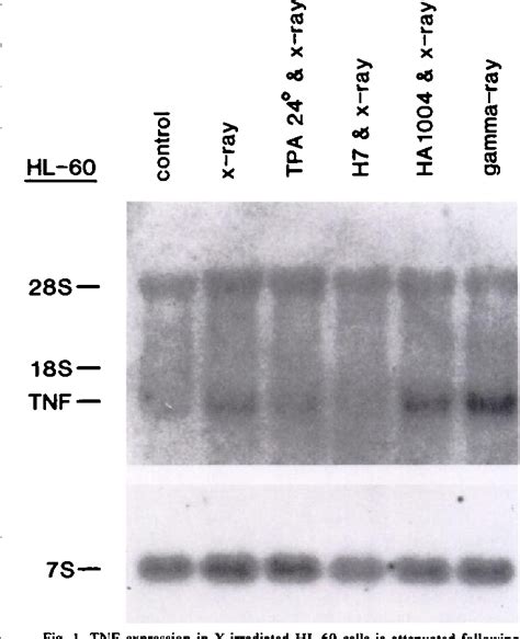 Figure 1 From Kinase C Following Activation By Ionizing Radiation Tumor Necrosis Factor Gene