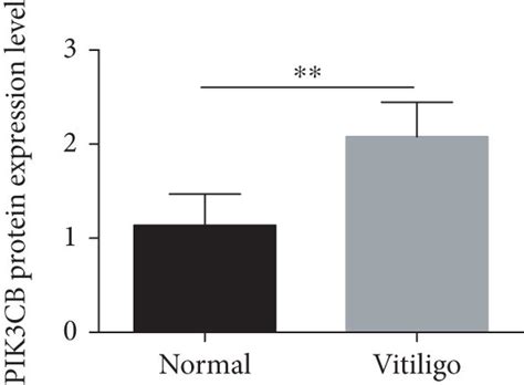 Validation Of Degs By Rt Qpcr And Western Blotting Among Identified