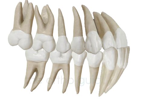 Class Iii The Ortho Guide