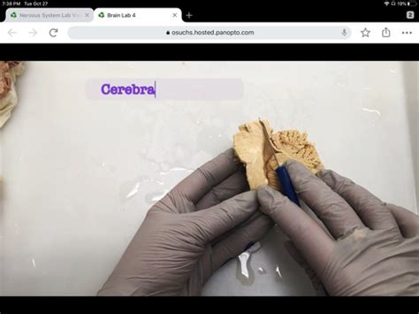 Neuro Lab 4 Flashcards Quizlet