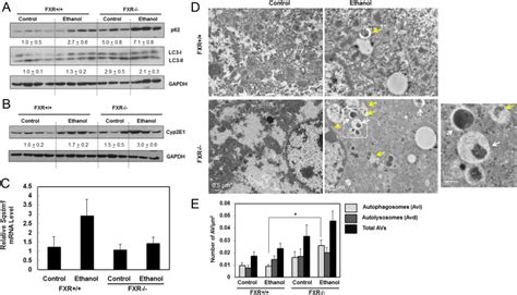 Ethanol Induced P62 And Lc3 Ii Protein Expression Was Enhanced In Fxr