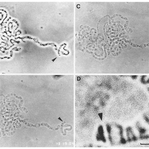 A B Microdissection Of A Drosophila Polytene Chromosome The