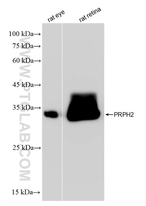 Prph2 Antibody 85043 2 Rr Proteintech