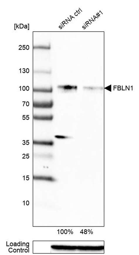 Fibulin 1 Antibody Ma5 24598