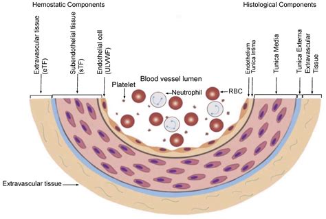 The Identity Of Thrombosis Encyclopedia Mdpi